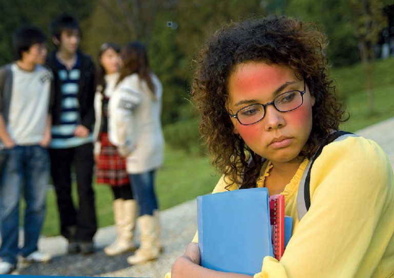 Sosiaalisten tilanteiden pelko - Sympatix